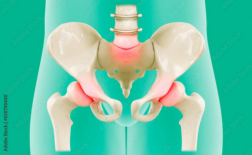 Intense pain in the cartilage joints, femoral head. Pelvis ...