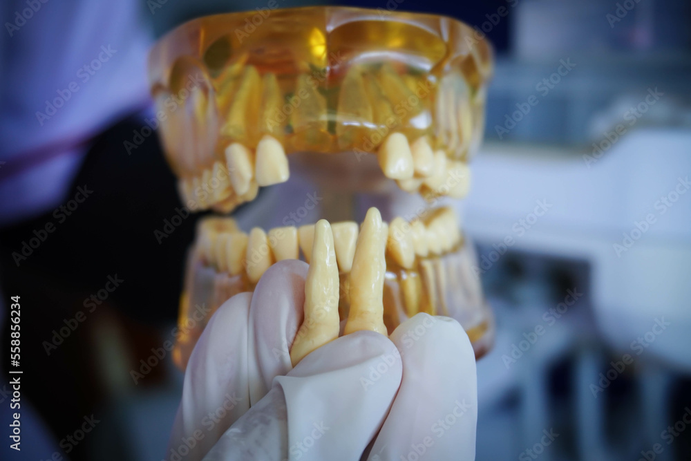 Dentist holding an artificial lower jaw. Dental Prosthesis. tooth plate ...