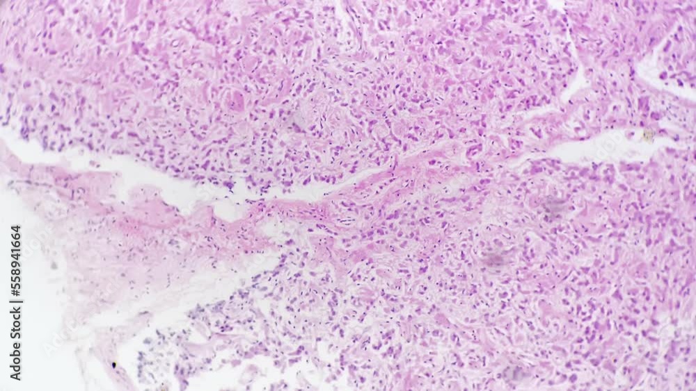 Human pineal body in section filmed under microscope with 100 times ...