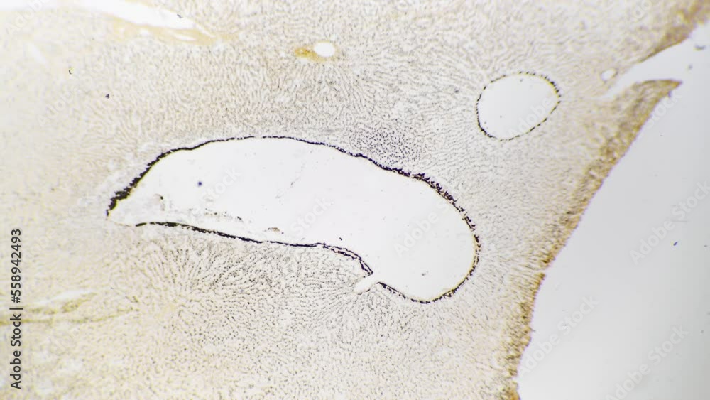 Cholangiole of the human being in section filmed under microscope 40x ...