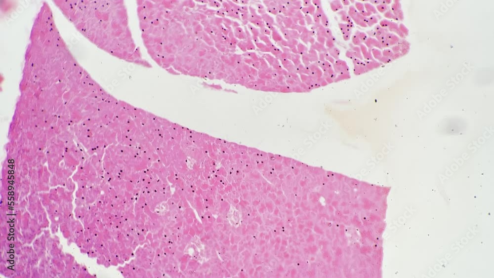 Stockvideo Section of human thymus gland shown with high magnification ...