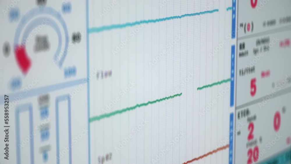 Health Parameters Test Medical Equipment Displays Patient Death. Heart ...