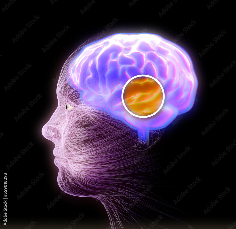 Memory lapses, forgetting things, degenerative disease. Brain problems ...