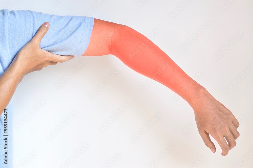 Pain in the upper arm of Asian young man. Concept of elbow and forearm ...