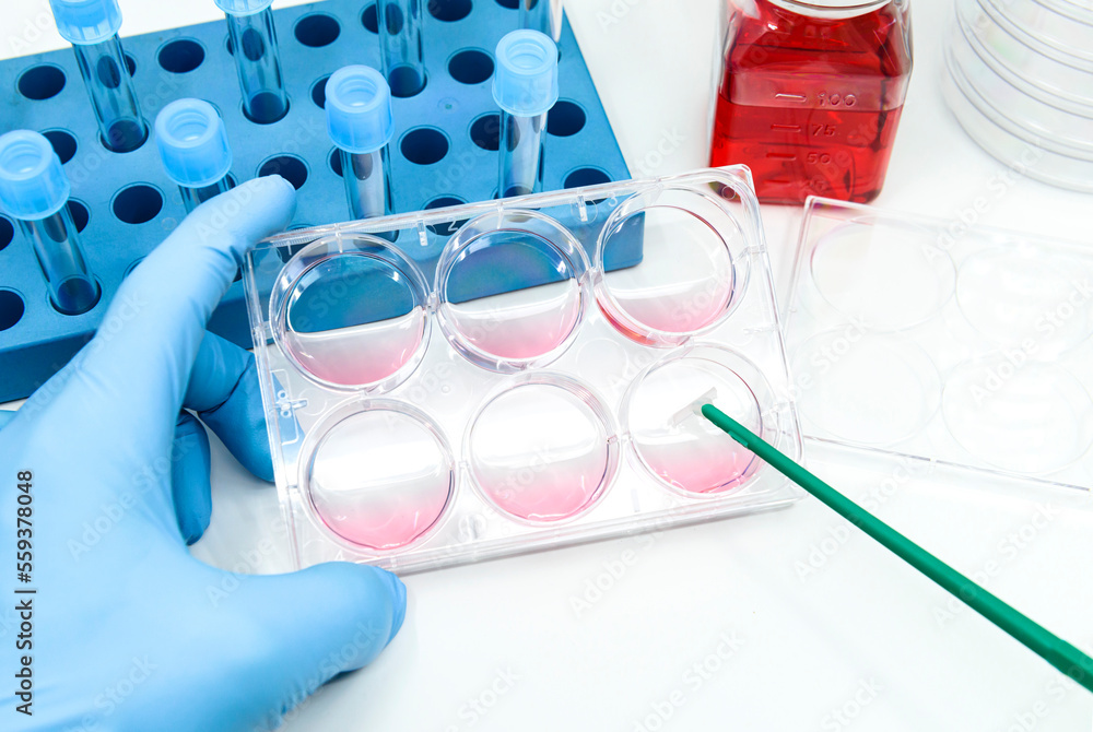 Scientist treats trypsin to detach adherent cells in 6 well plate and ...