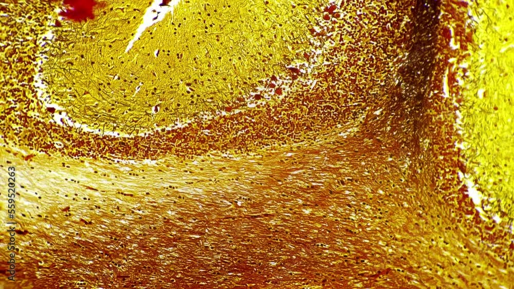 Silvering section of human cerebellum filmed under microscope 100x on ...