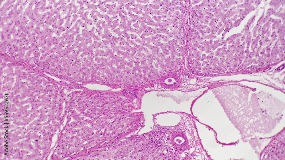 Human being liver filmed under microscope with 100 times magnification ...