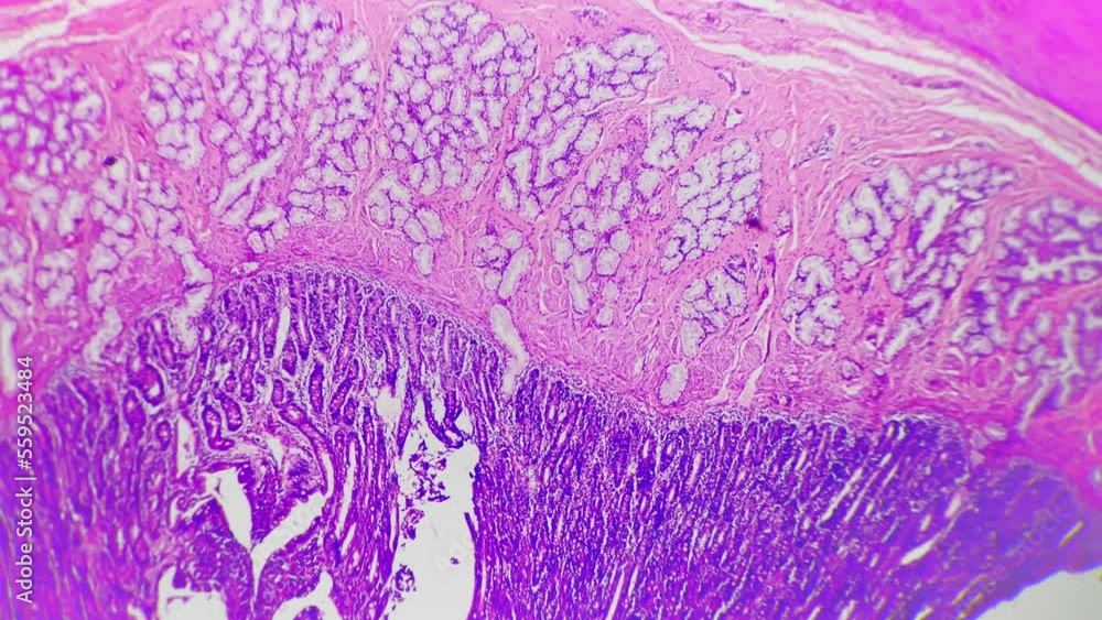 Duodenum of the human being in section shown under microscope with 40x ...