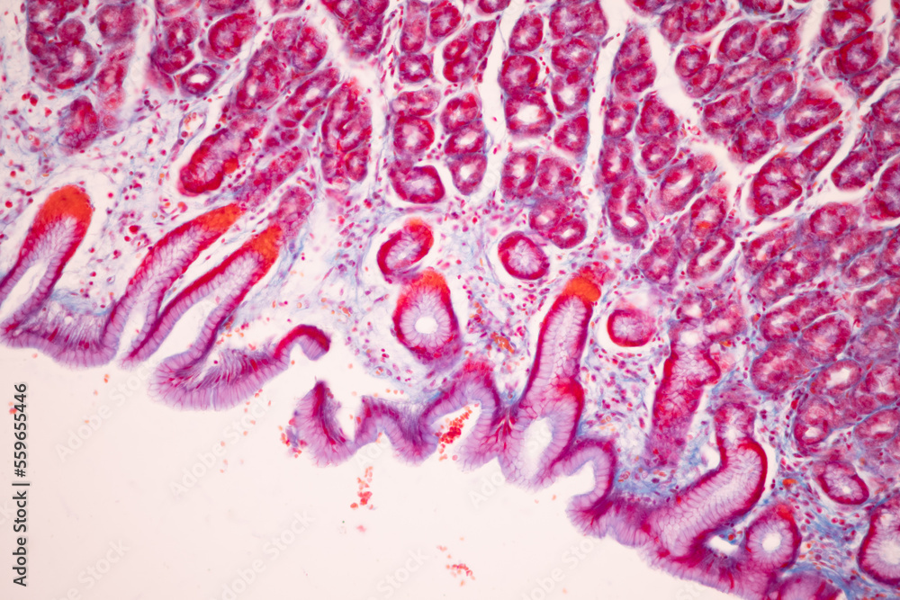 Tissue of Small intestine (Duodenum), Large intestine Human and Stomach ...