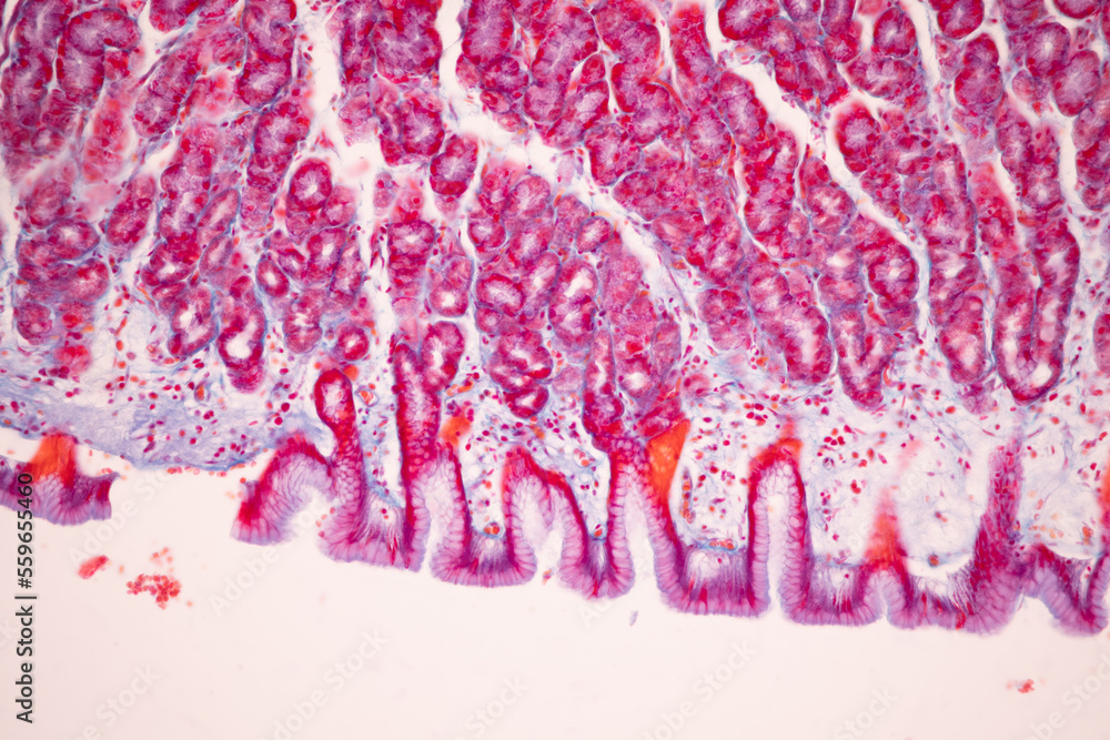 Tissue of Small intestine (Duodenum), Large intestine Human and Stomach ...
