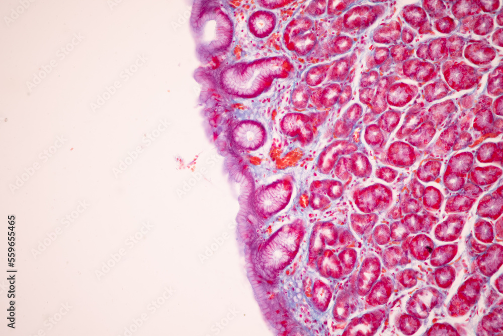 Tissue of Small intestine (Duodenum), Large intestine Human and Stomach ...