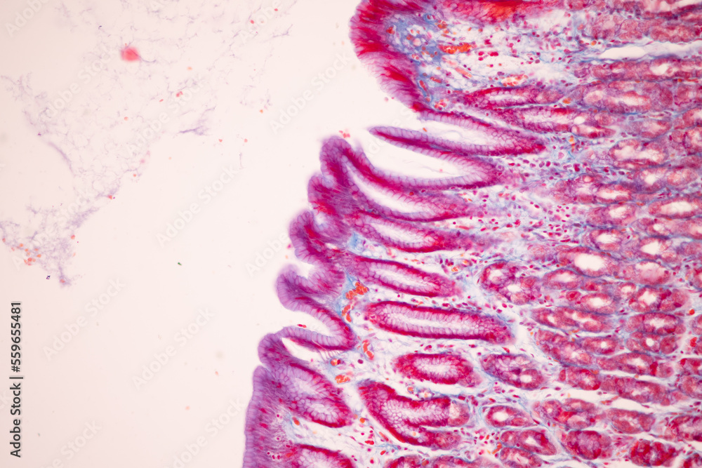 Tissue of Small intestine (Duodenum), Large intestine Human and Stomach ...