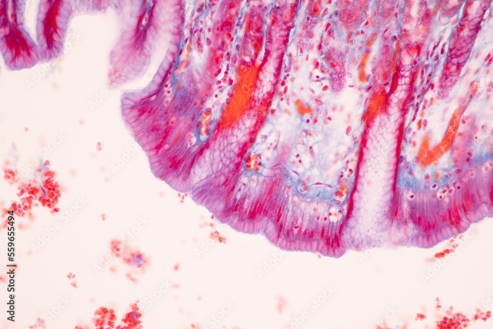 Tissue of Small intestine (Duodenum), Large intestine Human and Stomach ...