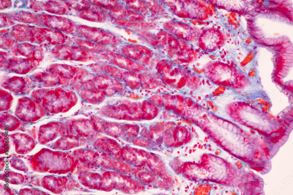 Tissue of Small intestine (Duodenum), Large intestine Human and Stomach ...