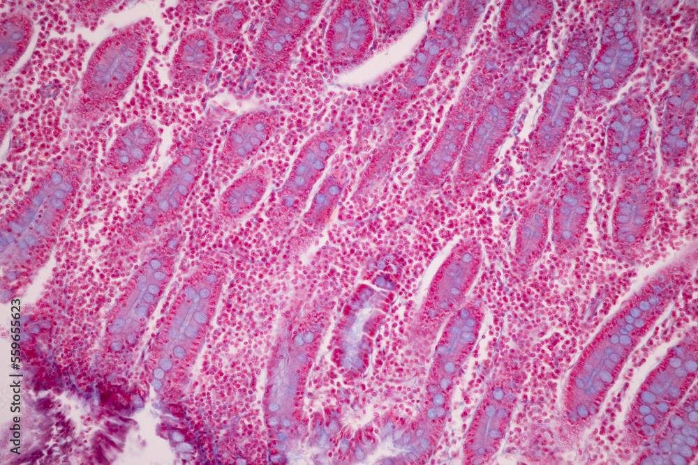 Tissue of Small intestine (Duodenum), Large intestine Human and Stomach ...