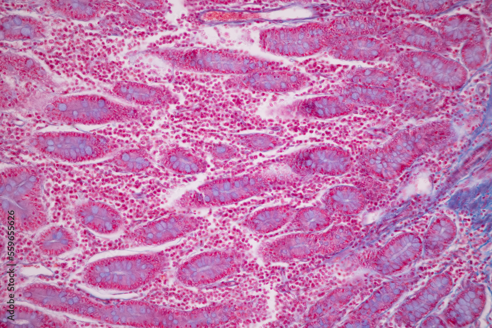 Tissue of Small intestine (Duodenum), Large intestine Human and Stomach ...