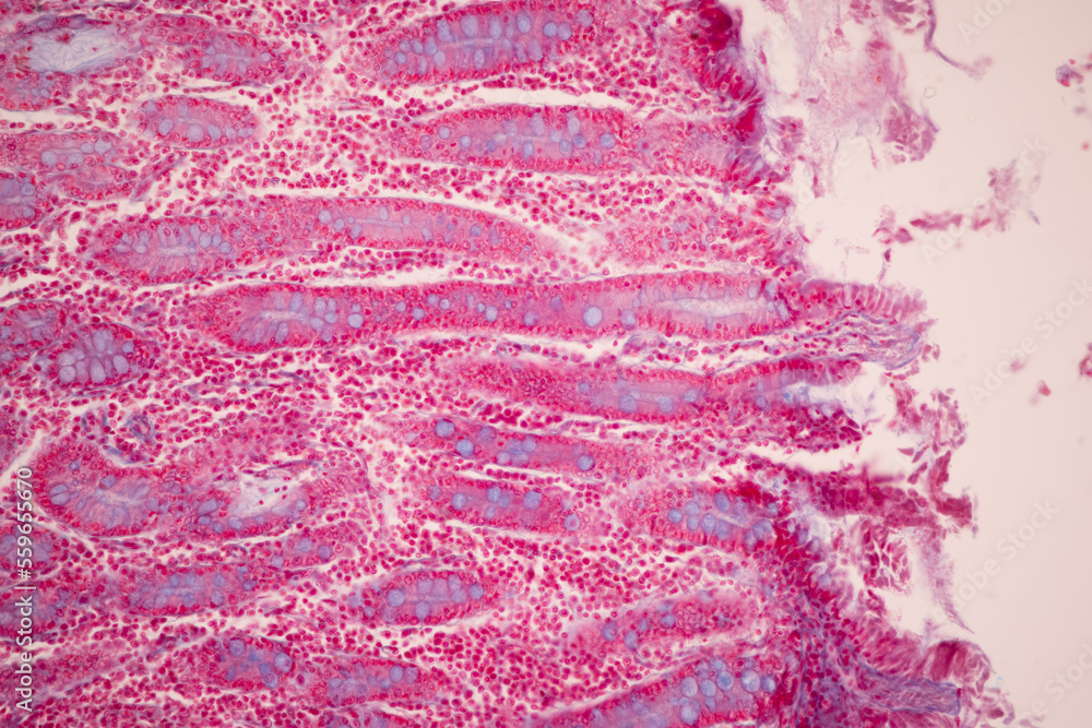 Tissue of Small intestine (Duodenum), Large intestine Human and Stomach ...