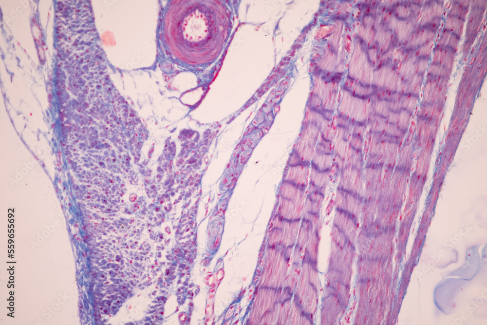 Tissue of Small intestine (Duodenum), Large intestine Human and Stomach ...