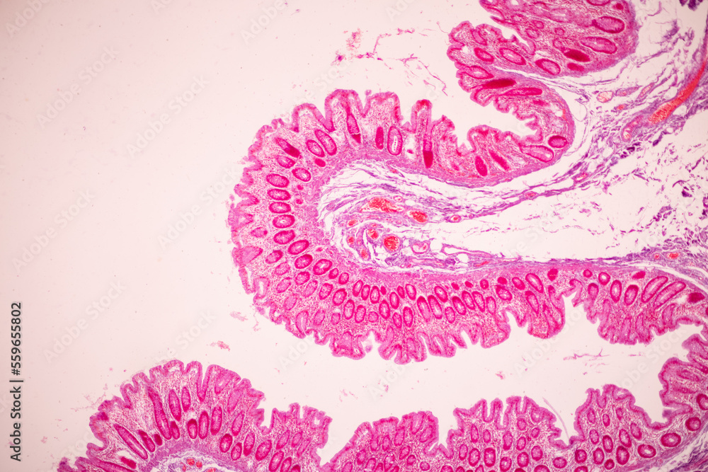 Tissue of Small intestine (Duodenum), Large intestine Human and Stomach ...