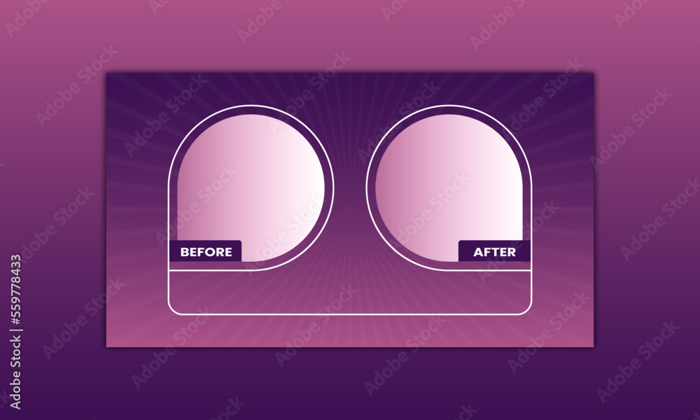 Before and after preview template banner or background template Stock ...