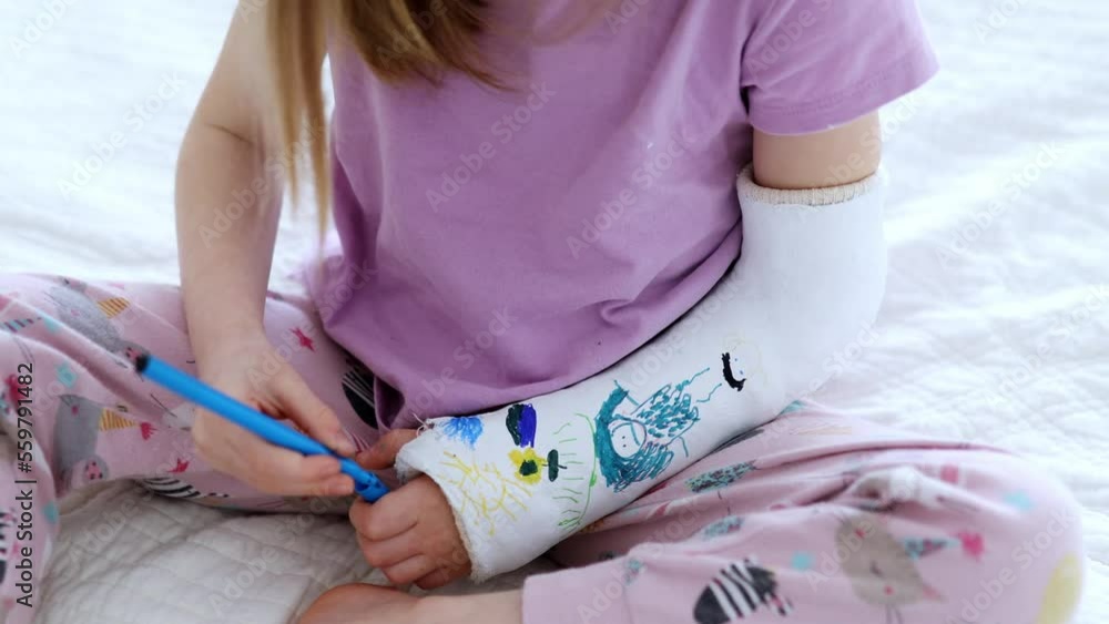 Adorable preschooler girl with a broken arm at home on the bed draws ...