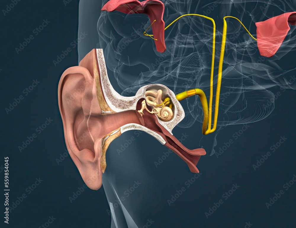 Sound passes through the ear and carries signals to the brain stem ... Sound passes through the ear and carries signals to the brain stem ...