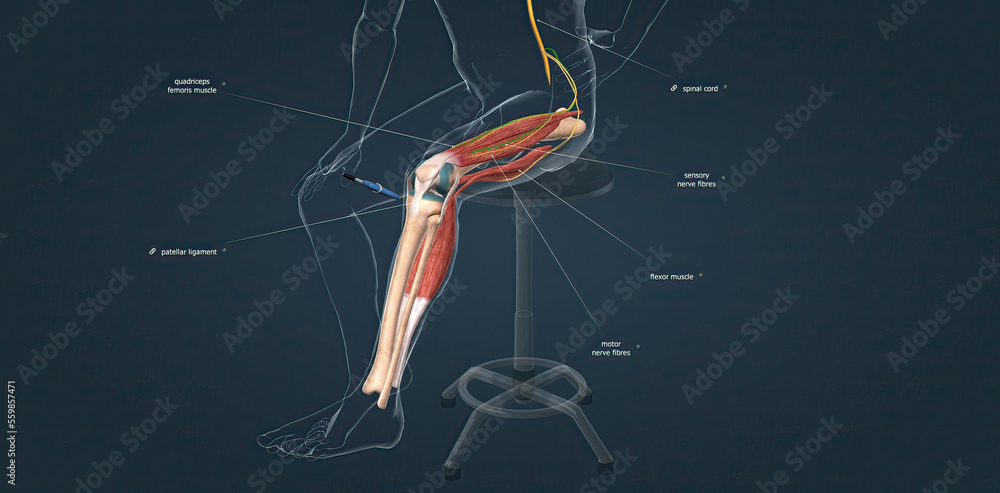 The patellar reflex is a reflex that causes the quadriceps muscle to ...
