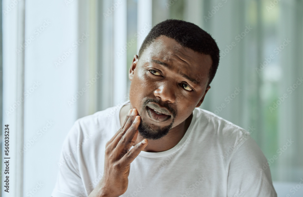 Sad, aesthetic and anxiety of black man with acne confused with face ...
