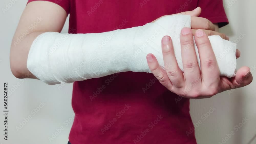 A man in a red T-shirt is stroking a broken arm in a cast on a light ...