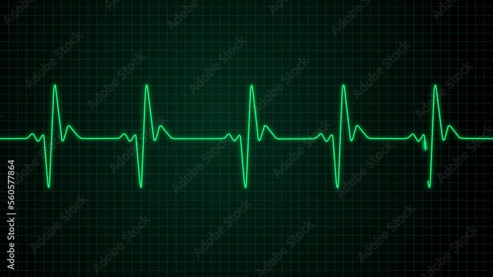 Patient monitor displays vital signs ECG electrocardiogram EKG, oxygen ...