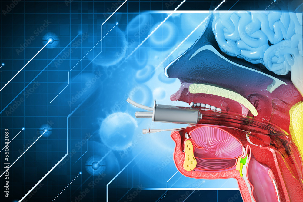 Endotracheal intubation on scientific background. 3d illustration Stock ... Endotracheal intubation on scientific background. 3d illustration Stock ...