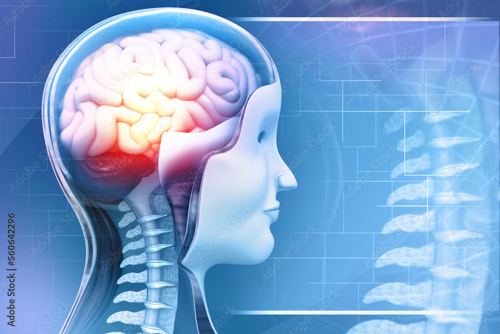 medically accurate illustration of a painful brain, Man with a headache ...