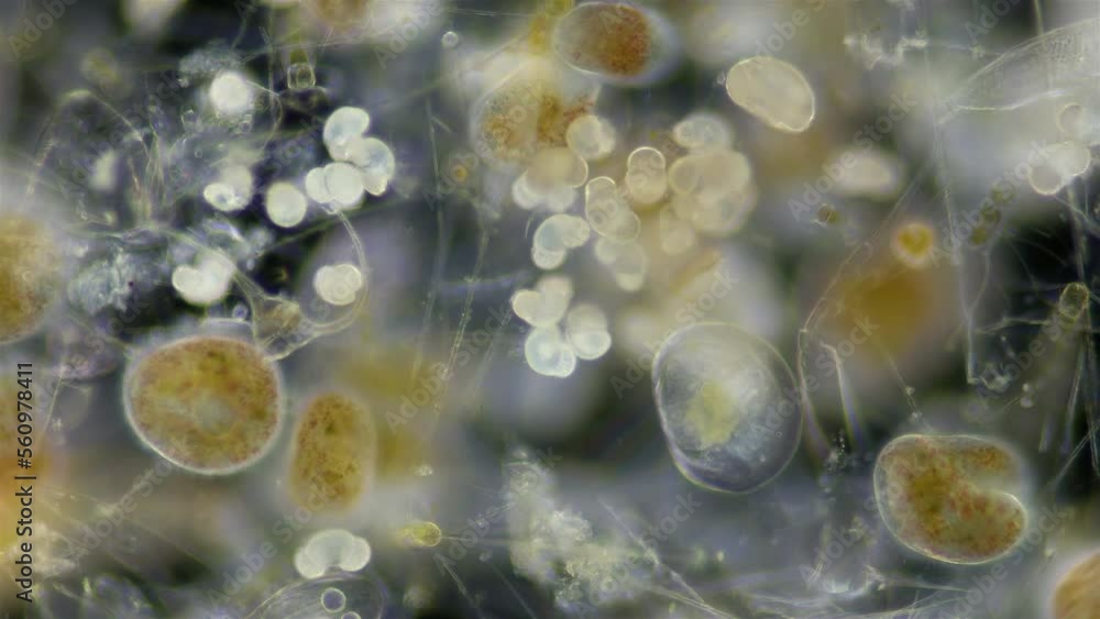 Trochophore larvae under a microscope, possibly at stage of ...