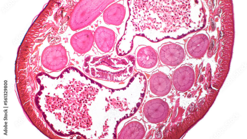 Ascaris lumbricoides under microscope. Haematoxylin end eosin stain ...