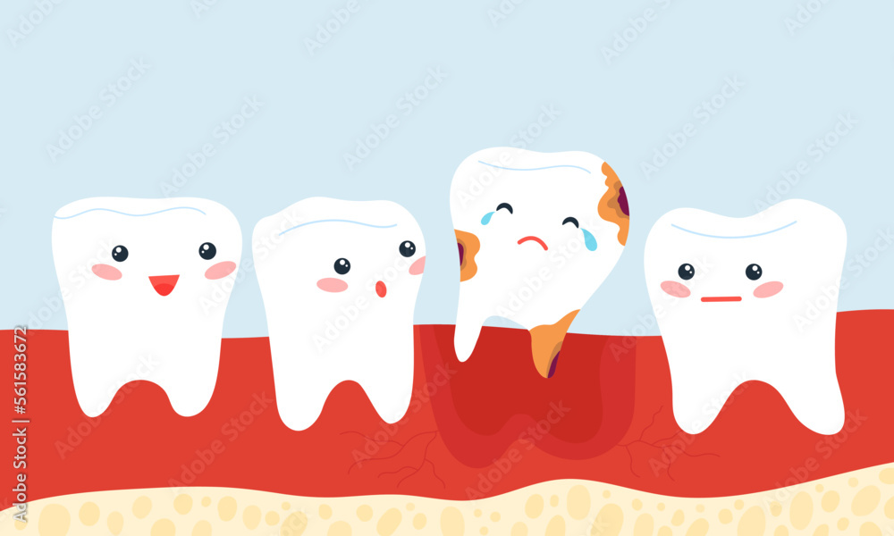 Cartoon sick tooth with caries falls out. Dentistry, pediatric ...