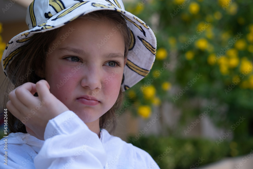 A girl with a painful hot sunburn, a problem of redness of the skin of ...