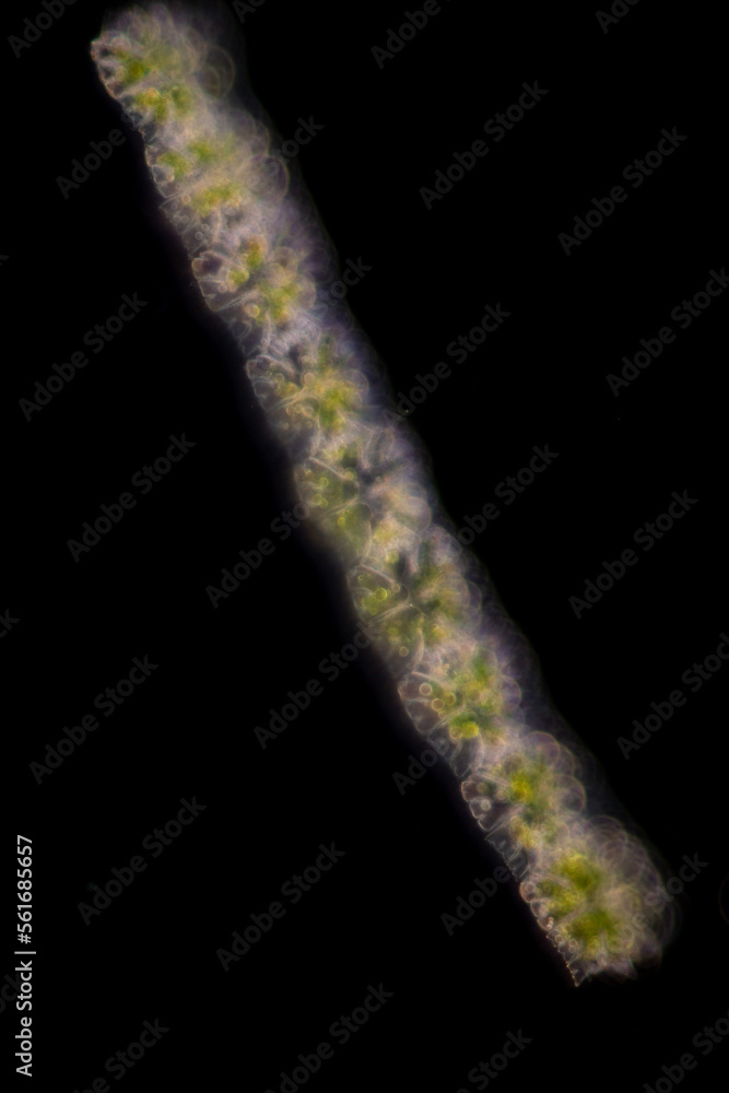 Study of protozoa and plant cells under the microscope for education ...