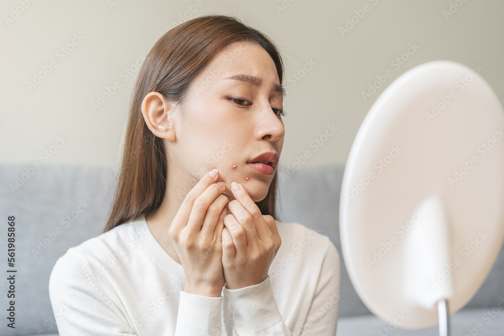 Expression worry asian young woman hand touching pustule around the ...