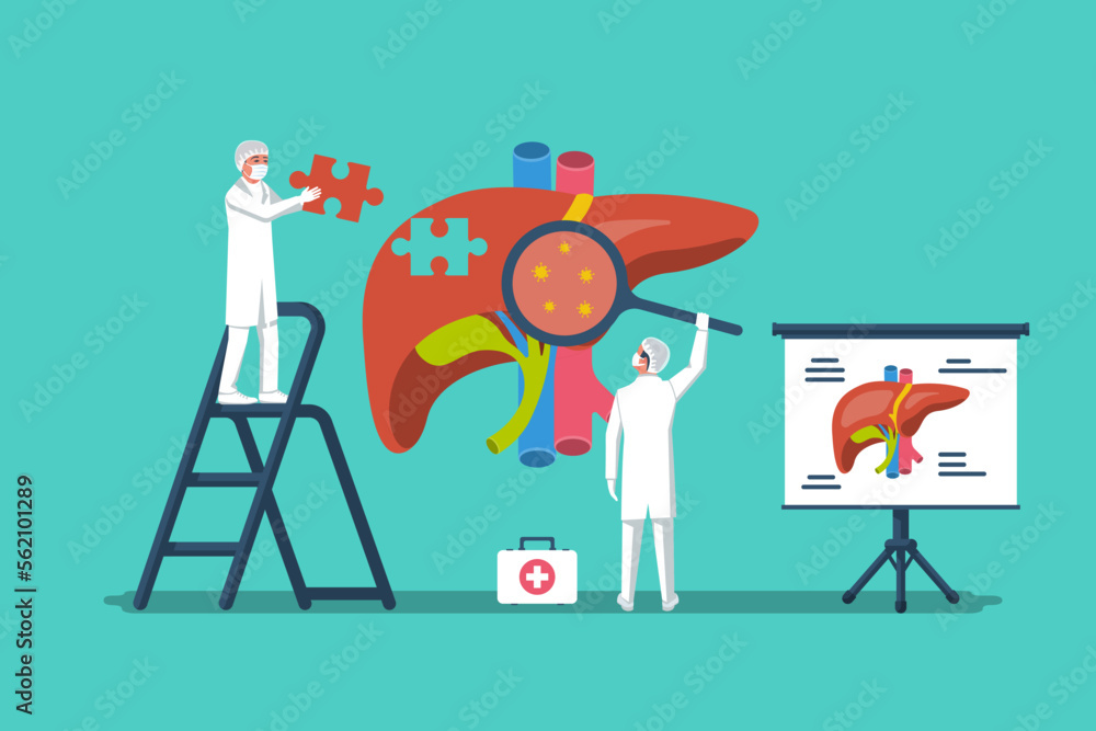 Vettoriale Stock Liver treatment. Doctors study the internal organs of ...