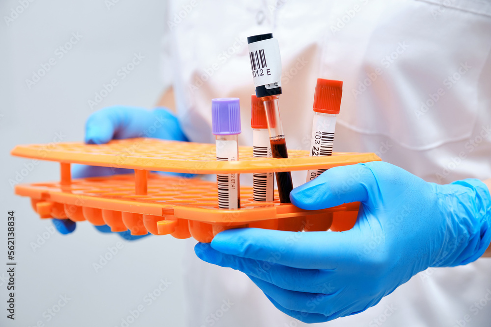 Doctor taking test tube with blue liquid, closeup. Laboratory analysis ...