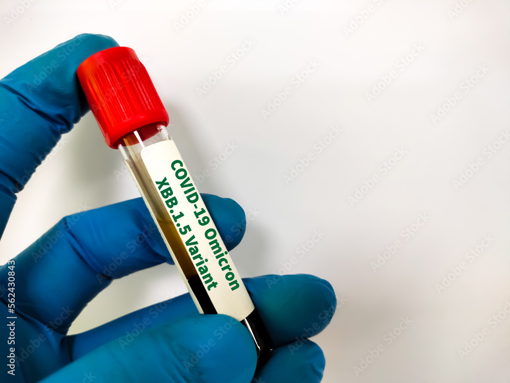 Blood sample for SARS-COV-2, COVID-19 Omicron XBB.1.5 variant test. The ...