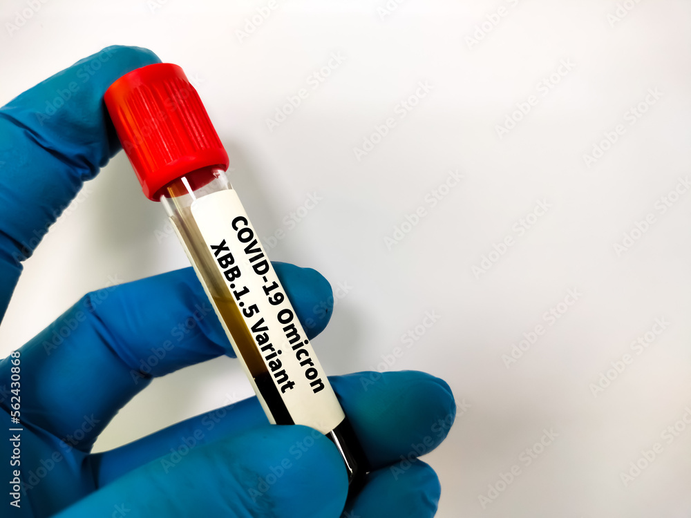 Blood sample for SARS-COV-2, COVID-19 Omicron XBB.1.5 variant test. The ...