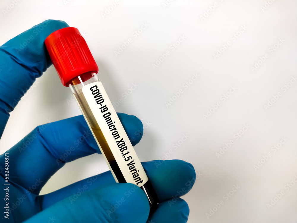 Blood sample for SARS-COV-2, COVID-19 Omicron XBB.1.5 variant test. The ...