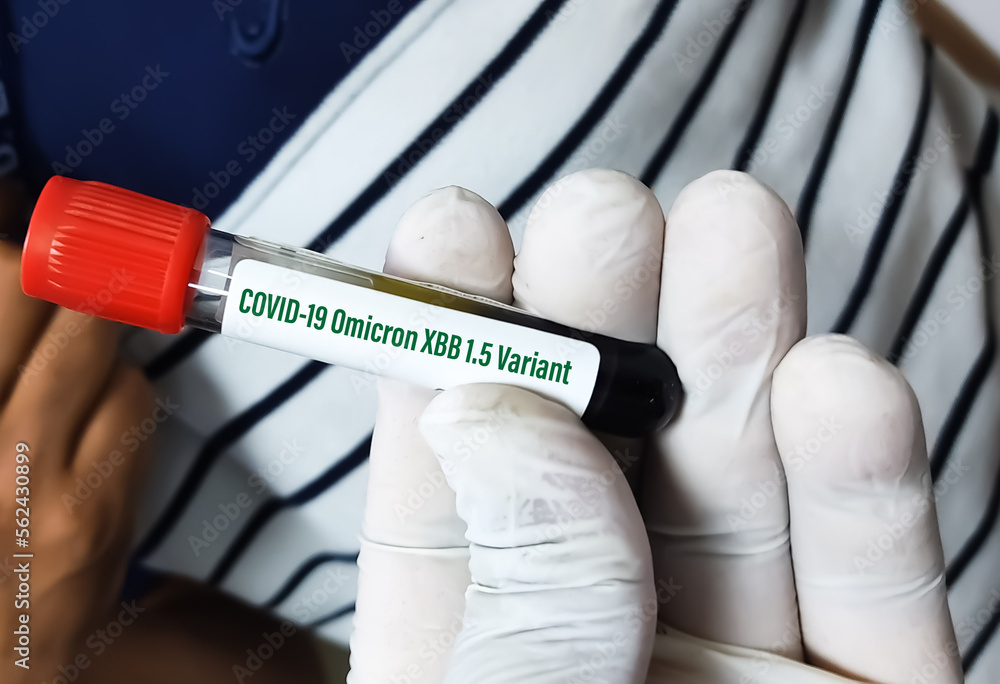 Blood sample for SARS-COV-2, COVID-19 Omicron XBB.1.5 variant test. The ...