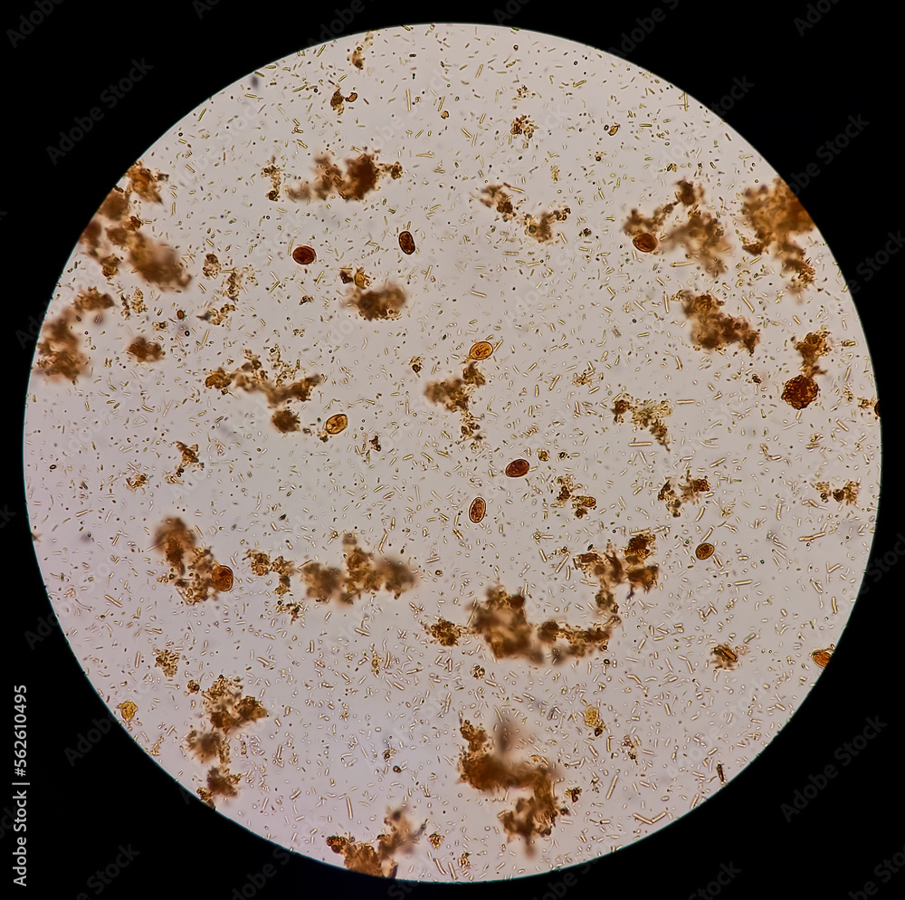 Giardia lamblia cysts and Trophozoite form, muscle fiber in stool ...