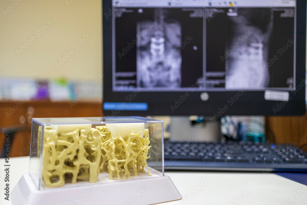 Close up photo of bone model inside examination room in hospital.Model ...