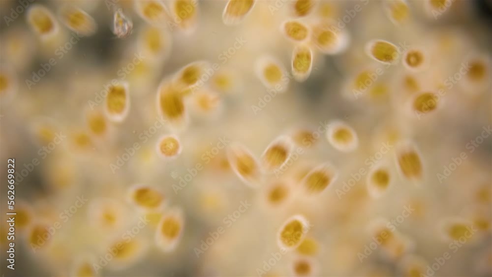 Trochophore larvae under a microscope, possibly at stage of ...