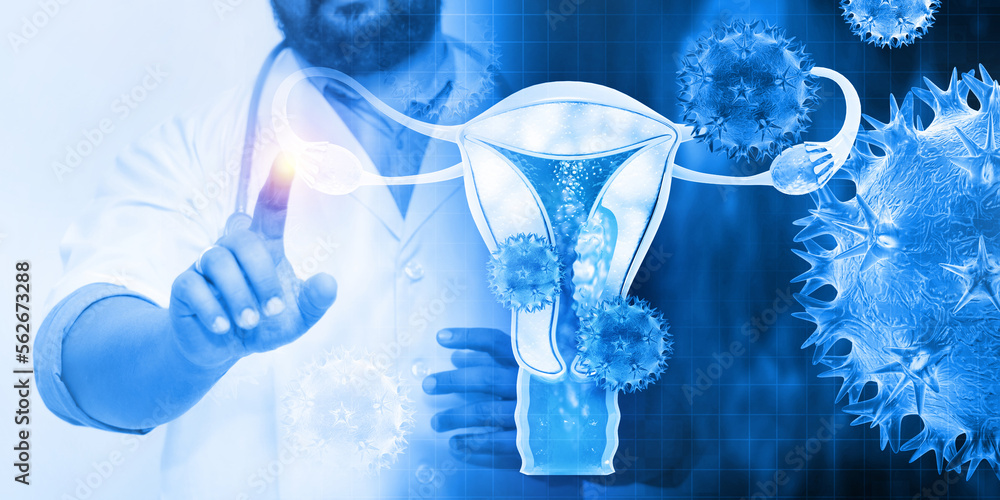 Doctor check and diagnose the Female reproductive system diseases on ...