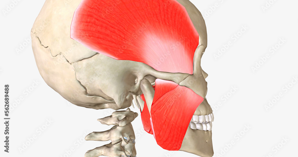 There are four muscles of mastication. Masseter, temporalis, medial ...