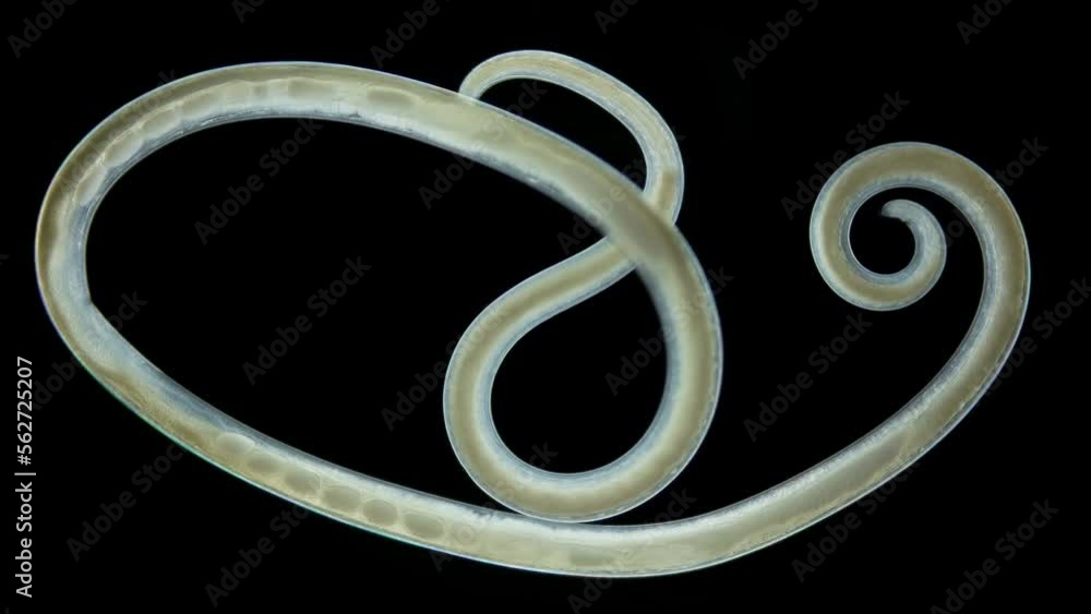 worm Nematoda under microscope, Phylum Protostomia, free-living ...